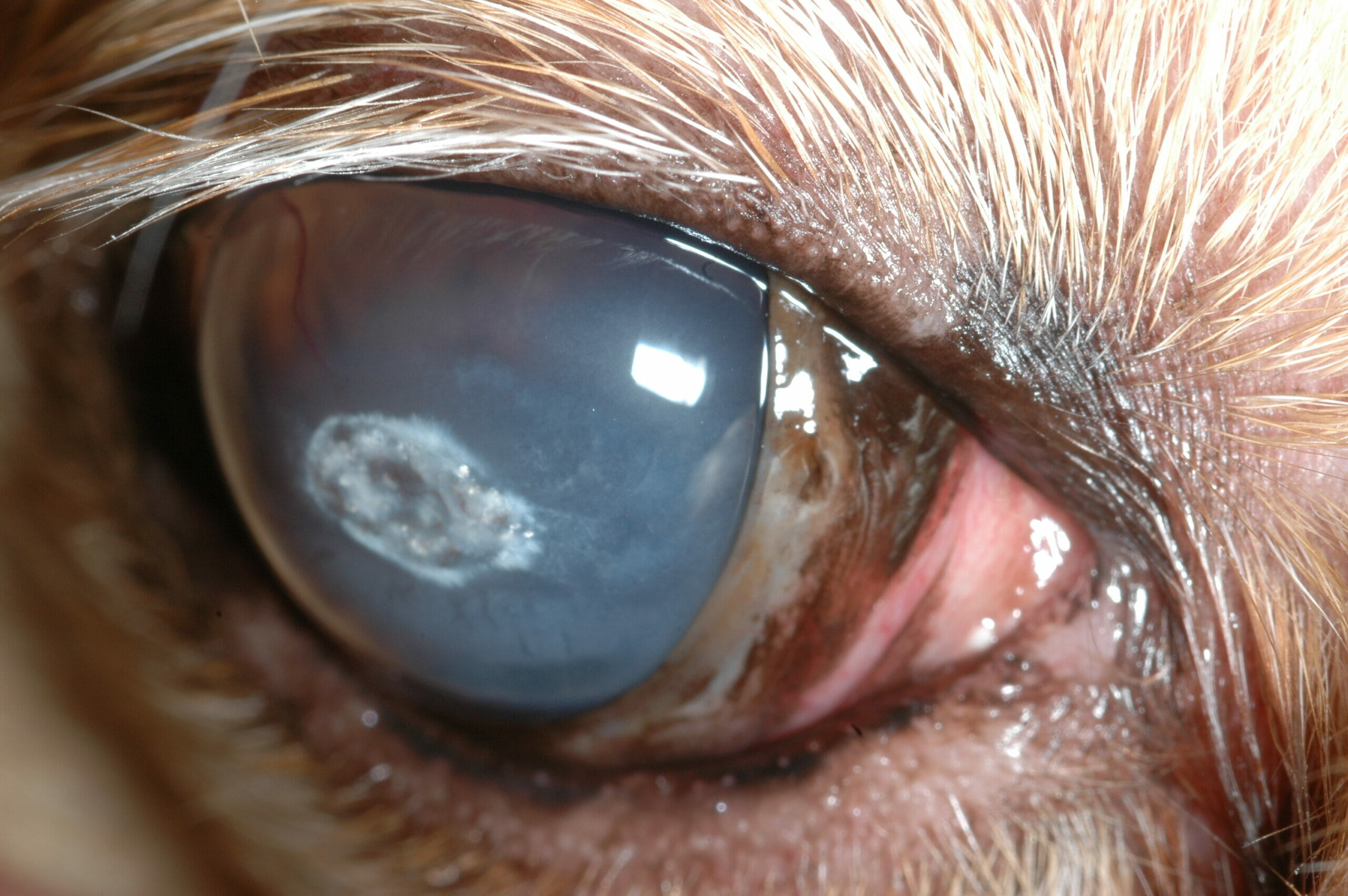 Corneal Ulcer Contact Lens